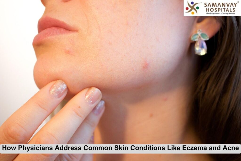 Acne and eczema: How Doctors Handle These Skin Conditions