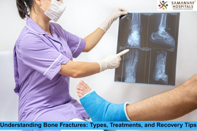 Bone Fractures: Types, Treatment, and Healing Tips