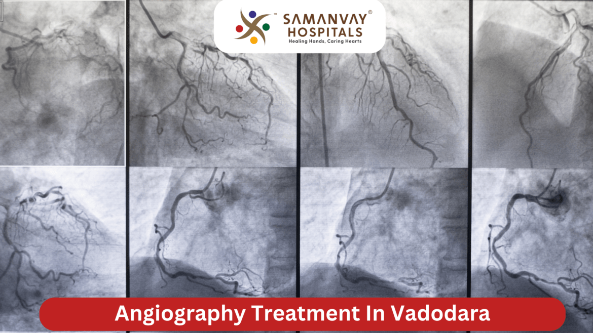 Angiography Treatment in Vadodara | Samanvay Hospital
